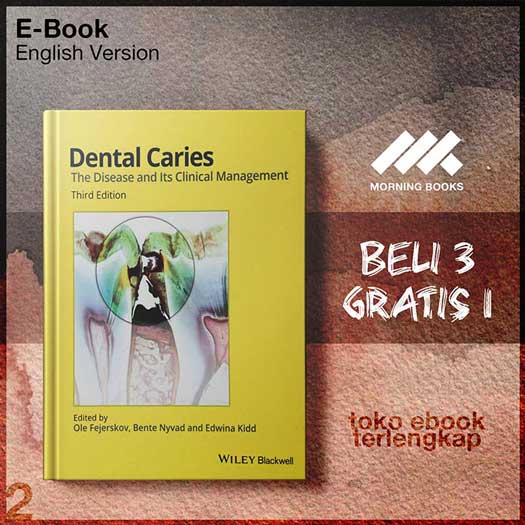 Dental Caries The Disease and its Clinical Management by Ole Fejersk ...