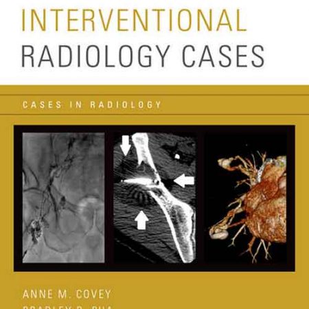 Interventional Radiology Cases – Morning Store